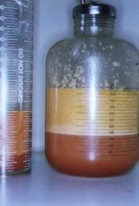 Lipoescultura – Centro Dermatológico Leal